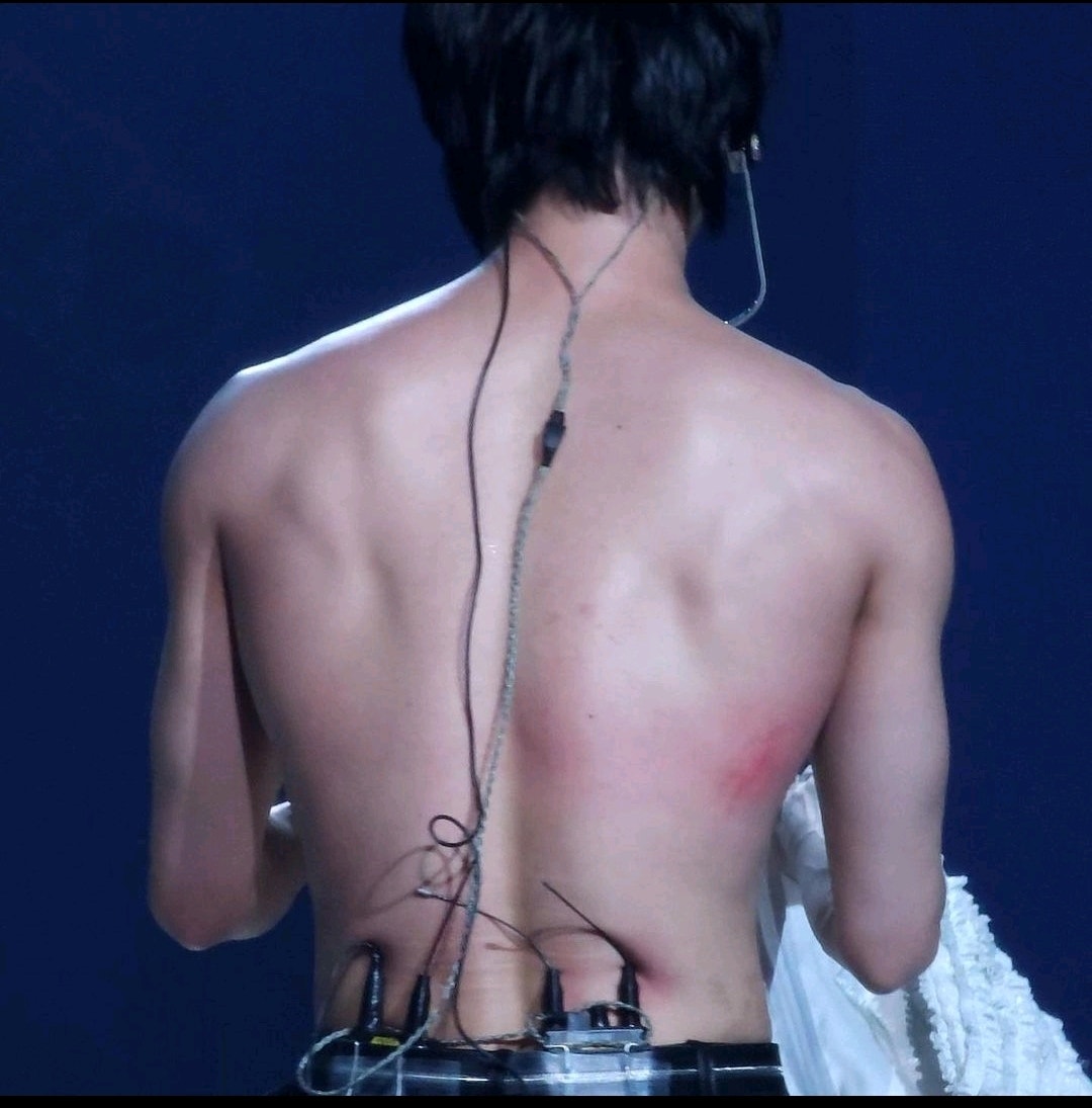 SHINee Community Post - 울 탬니 등 빨갛게 된거 아프겠당..ㅠㅠ 맴찢. 😭😭 아프지마 우리 탬니야. 약 잘 바르고 쉬고 있누..? 그나저나 실제로 보니 ...