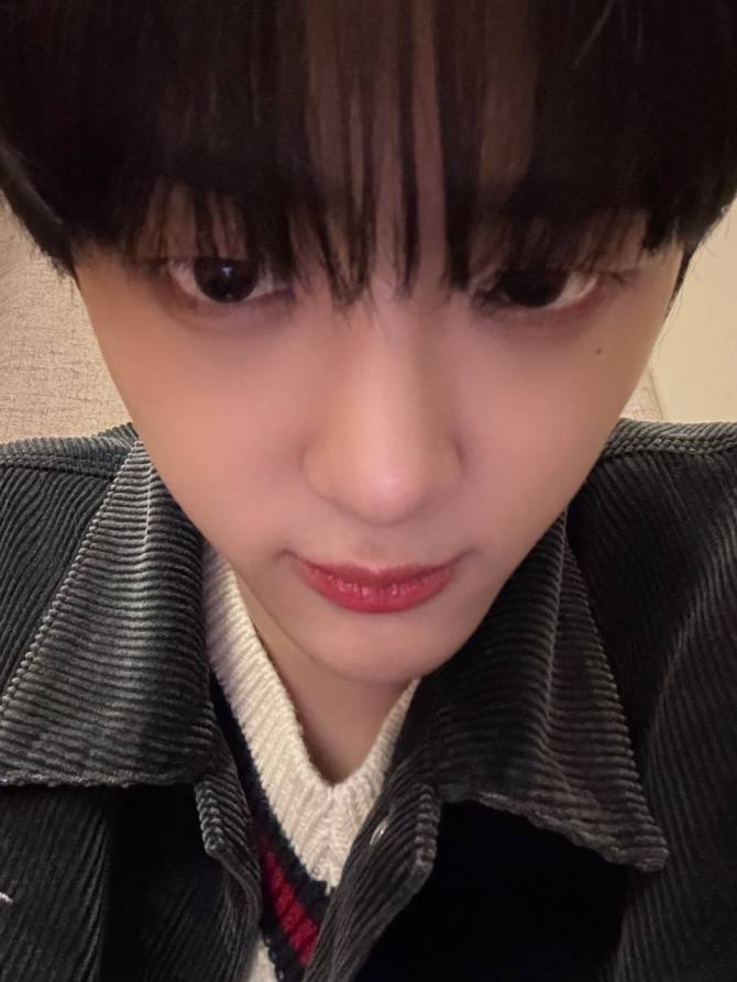 Lun8 Community Post 오늘 하루도 고생 많았어ㅓ 나는 아까 새끼 발가락을 찧고 잠깐 다른 사람이 됐다가 이제