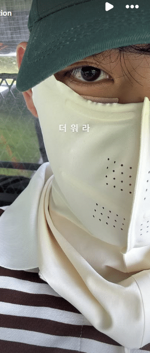 BTS Community Post - I'm glad to see u again 😭💜 but how did u get hurt tae pls tell us 🥺