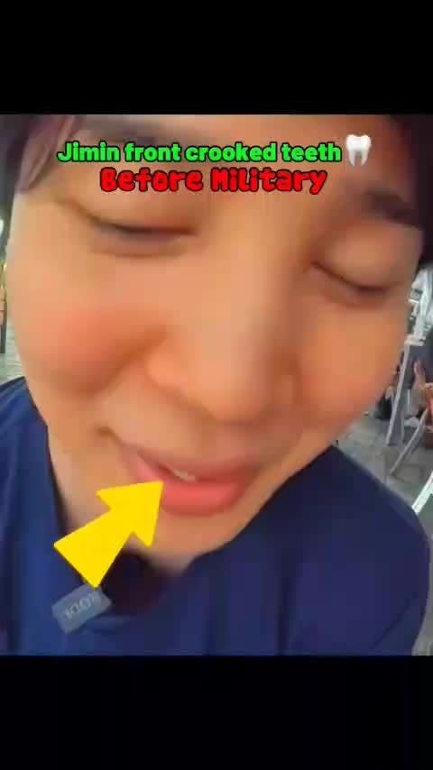 BTS Community Post - Jimin fixed his crooked teeth 🦷😭 #bts #jimin