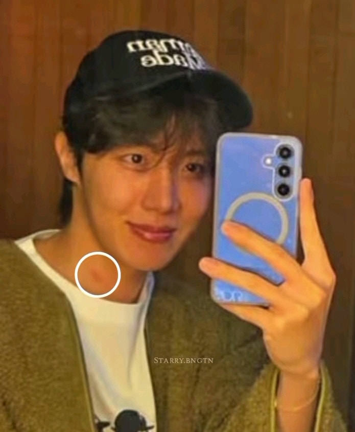 BTS Community Post - j hopeee 😩😩😭 what is this ! who gives you love bite on neck 😠😠 monalisa ...